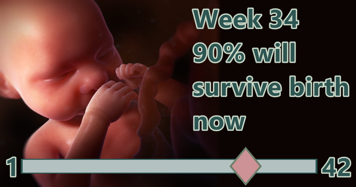 BirthWatch | Week 34: 90% of babies born... - BirthWatch